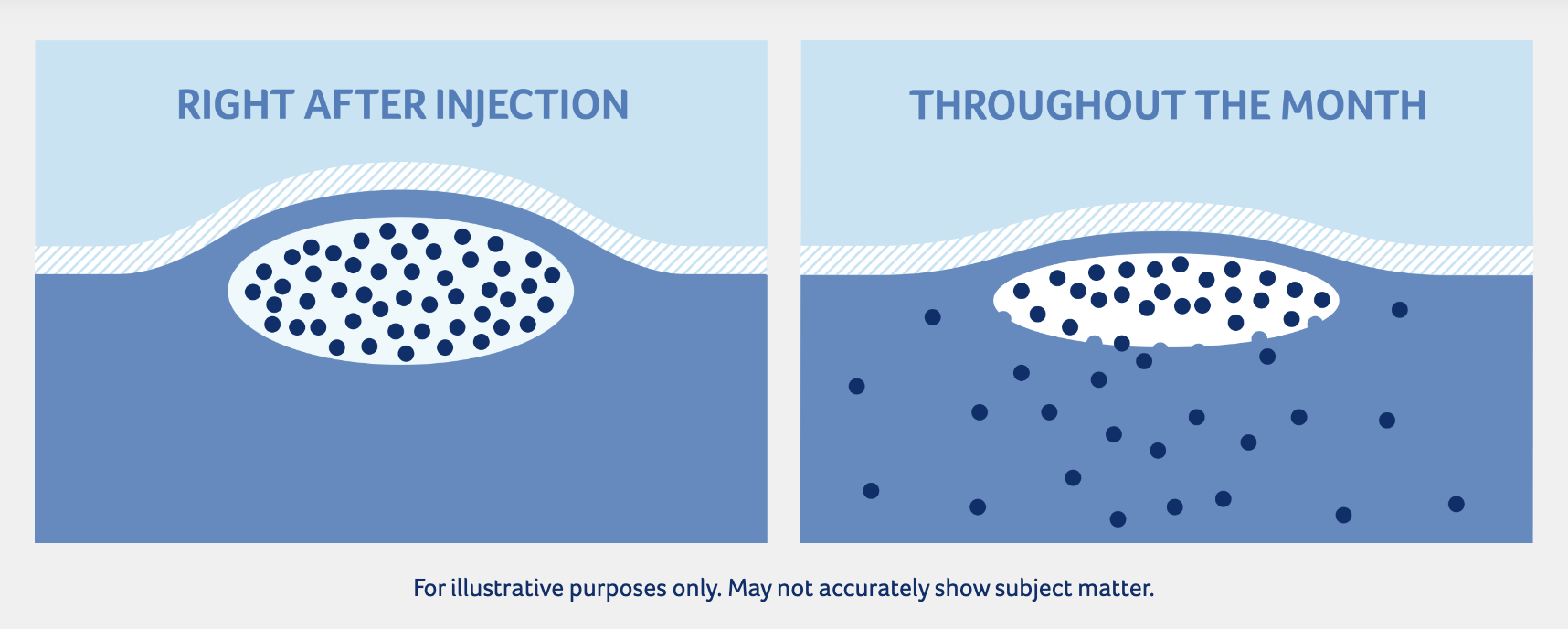 Extended-Release Buprenorphine: Frequently asked questions - Better ...